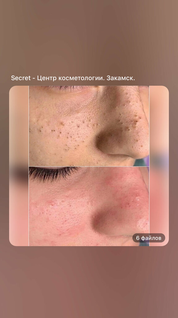 Kozmetoloji, kozmetik salonları Secret, Perm, foto