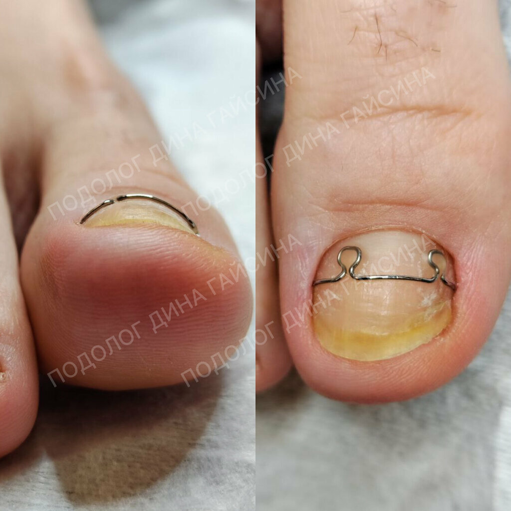 Manikür-pedikür Podologist Dina Gaysina, Liubertsy, foto