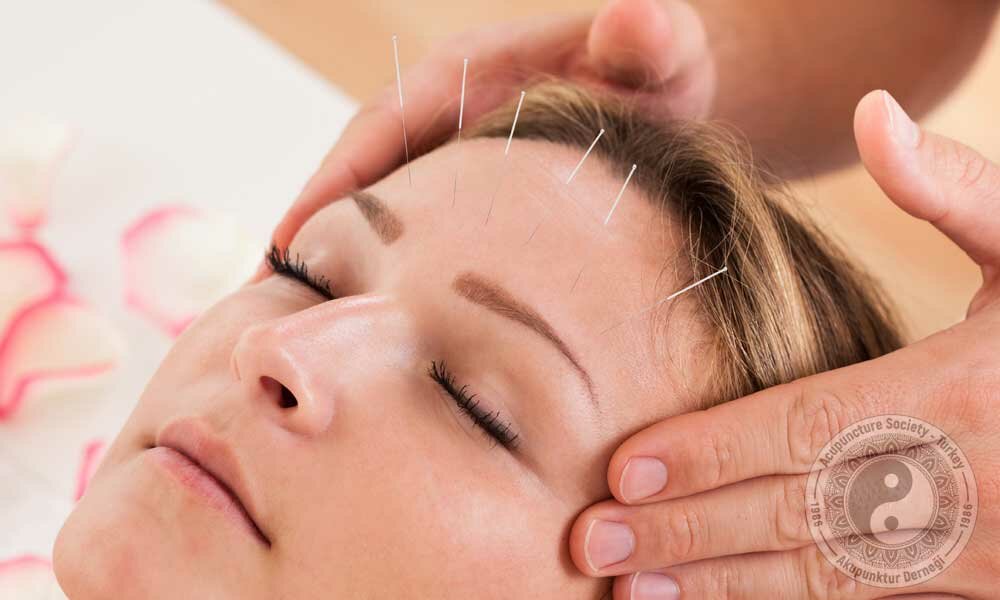 Alternatif tıp merkezleri Akupunktur Derneği, İstanbul, foto