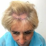 Saç kaynak işlemi (Antalya, Muratpaşa, Gençlik Mah., 1315. Sok.), güzellik salonu  Antalya'dan