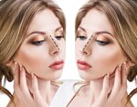MediAvrupa Estetik Burun Estetiği Meme Estetiği Popo Estetiği Liposuction Karın Germe Mommy Makeover/ (İstanbul, Büyükdere Cad., 1), plastik cerrahi klinikleri  İstanbul'dan