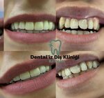 Dental İz Ağız Ve Diş Sağlığı Kliniği (Batman, Batman Merkez , Bahçelievler Mah.), özel ağız ve diş sağlığı klinikleri ve muayenehaneleri  Batman'dan