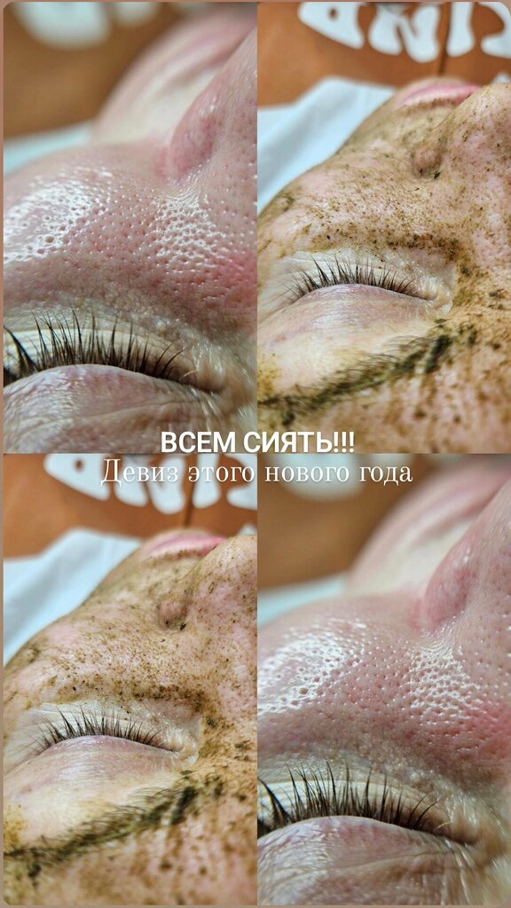 Kozmetoloji, kozmetik salonları Студия Эстетики by Ramazanova, Moskova ve Moskovskaya oblastı, foto