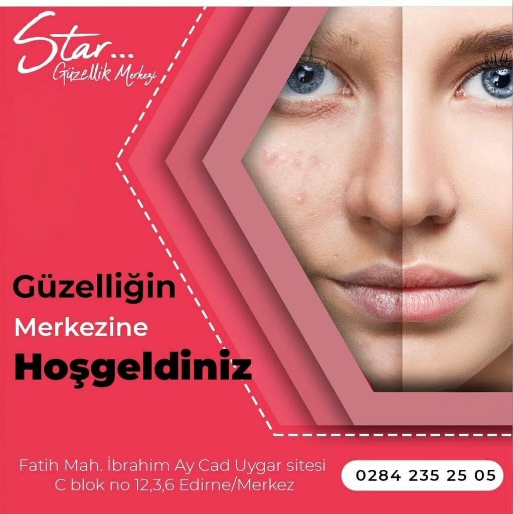 Güzellik salonu Star Güzellik Salonu, Edirne, foto