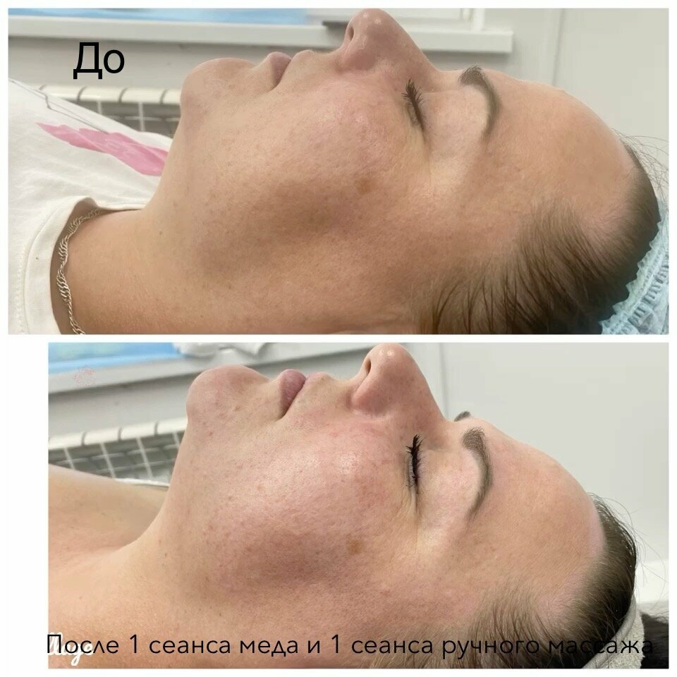 Kozmetoloji, kozmetik salonları Косметолог-эстетист, Pereslavl‑Zalesski, foto