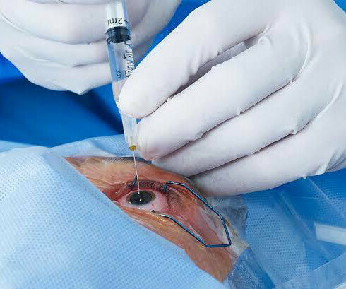 Göz sağlığı merkezleri Retina Perú, Lima, foto