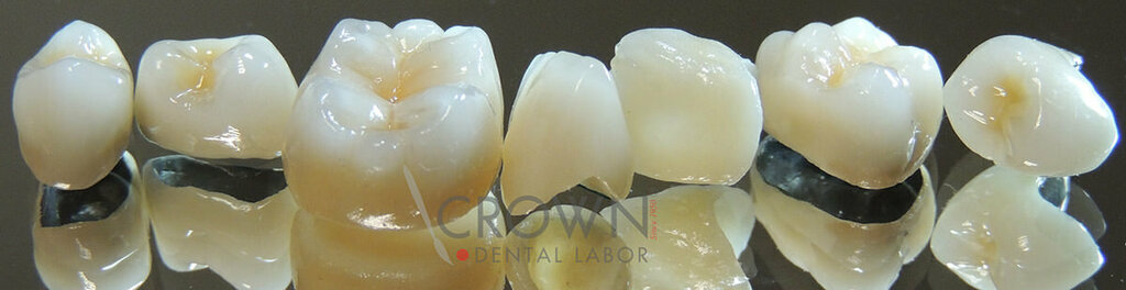 Diş laboratuvarı Crown Diş Protez Lab, Bursa, foto