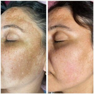 Dolunay Güzellik Salonu (Kırşehir, Kaman, Çiftlikli Mah., 25 Aralık Cad., 6), güzellik salonu  Kaman'dan