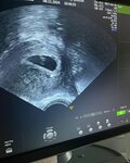 Gynist Ivf Clinic - Ivf Turkey, infertilite, Egg Freezing (İstanbul, Şişli, Vali Konağı Cad., 129), jinekoloji kliniği  İstanbul'dan