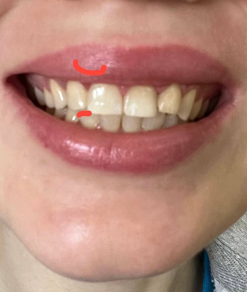 Özel ağız ve diş sağlığı klinikleri ve muayenehaneleri Zubnoy doktor, Novoçerkassk, foto