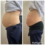 Formes Clinic Diyetisyen Edanur Akkuş Tosun Sağlıklı Yaşam Ve Diyet Merkezi Andulasyon Terapi Uzmanı Ve Ozon Tedavi (Kayseri, Melikgazi, Şht. Ütğm. Mustafa Şimşek Blv., 103), özel muayenehaneler  Kayseri'den