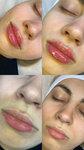 Skin (ulitsa imeni Valeriya Gassiya No:11), kozmetoloji, kozmetik salonları  Krasnodar'dan