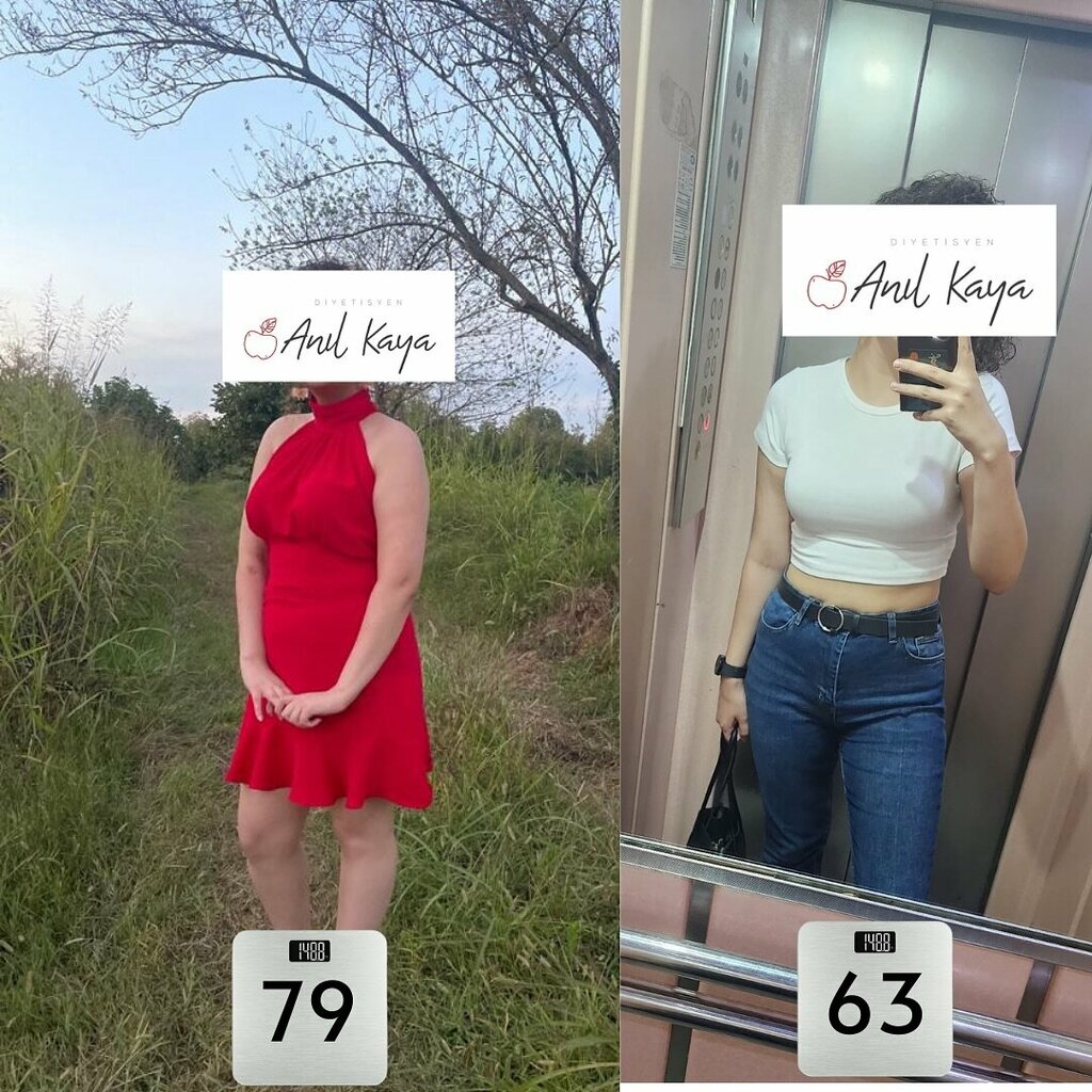 Özel muayenehaneler Uzman Diyetisyen Anıl Kaya, Mersin, foto