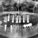 Implance (Ankara, Çankaya, Büklüm Cad., 23), özel ağız ve diş sağlığı klinikleri ve muayenehaneleri  Ankara'dan