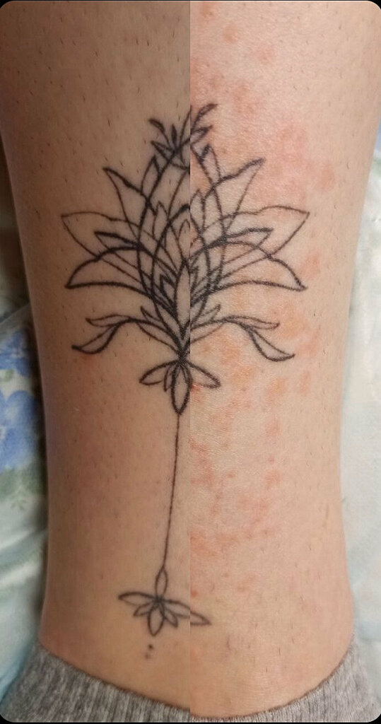 Epilasyon Electroepilation, Moskova, foto