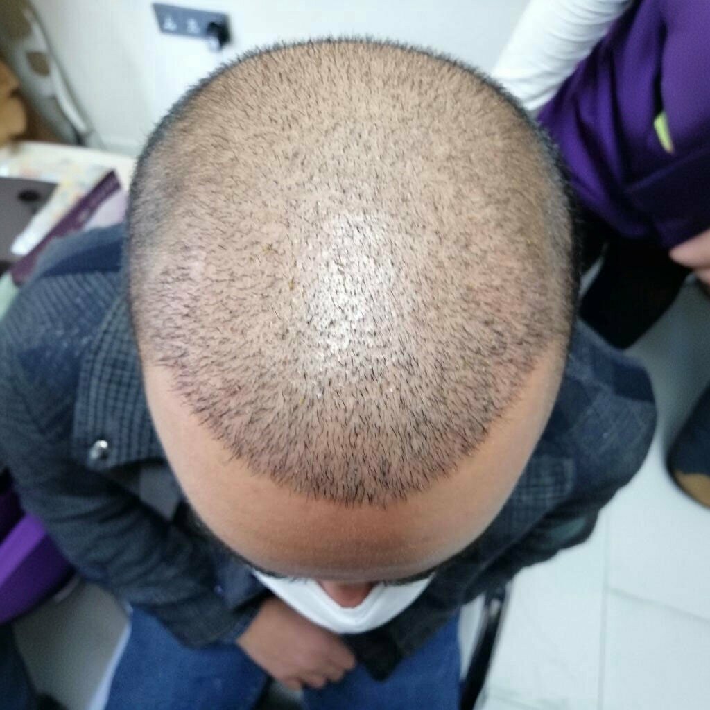 Güzellik salonu EsteWolf Hair Kayseri Saç Ekimi, Kayseri, foto