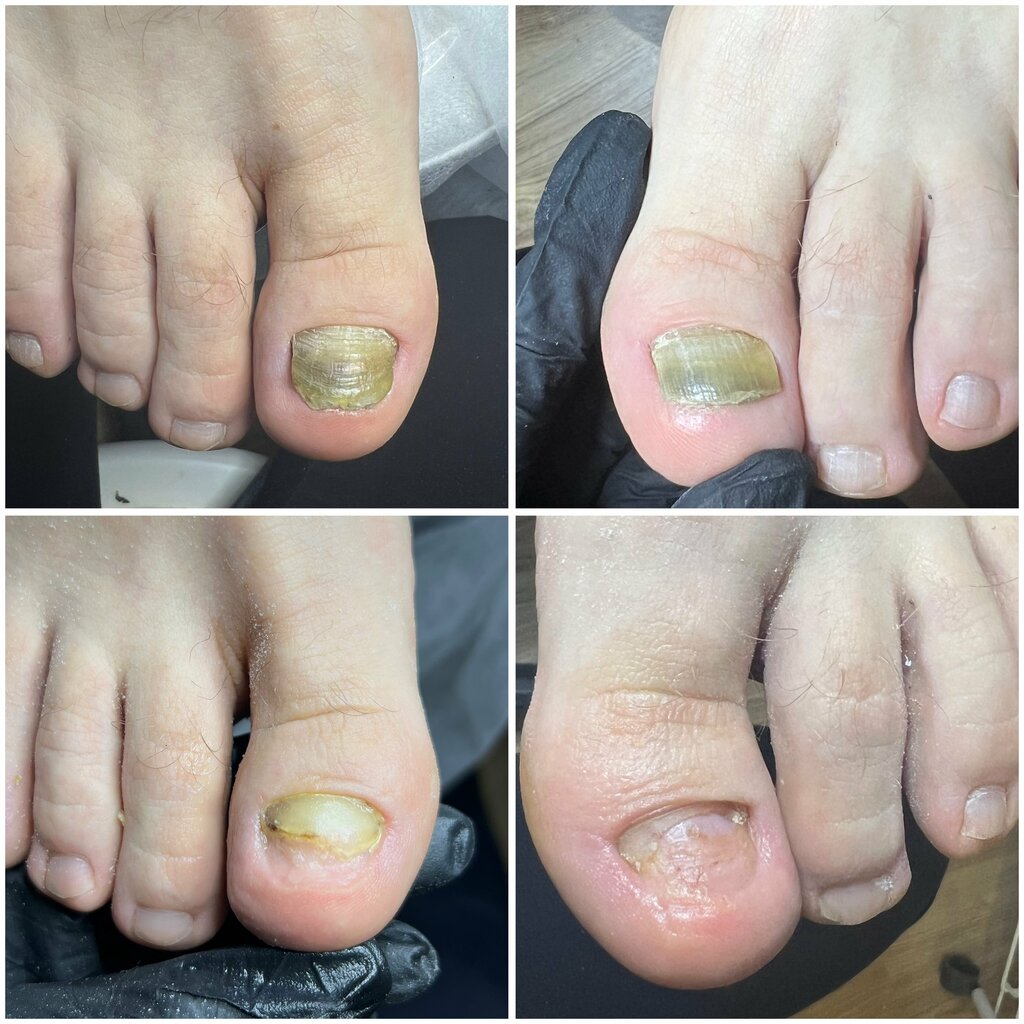 Podoloji Podo Help, Nijegorodskaya oblastı, foto