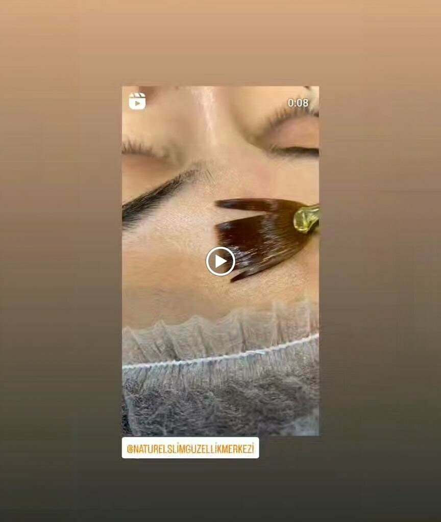 Epilasyon Naturel Slim Güzellik Merkezi ve Lazer Epilasyon, Burdur, foto