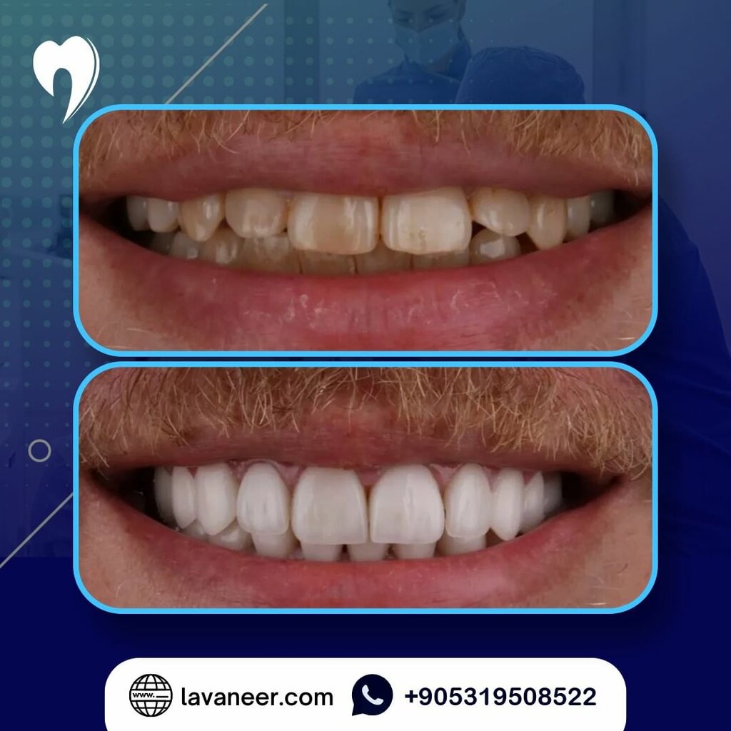 Özel ağız ve diş sağlığı klinikleri ve muayenehaneleri LaVaneers, İstanbul, foto