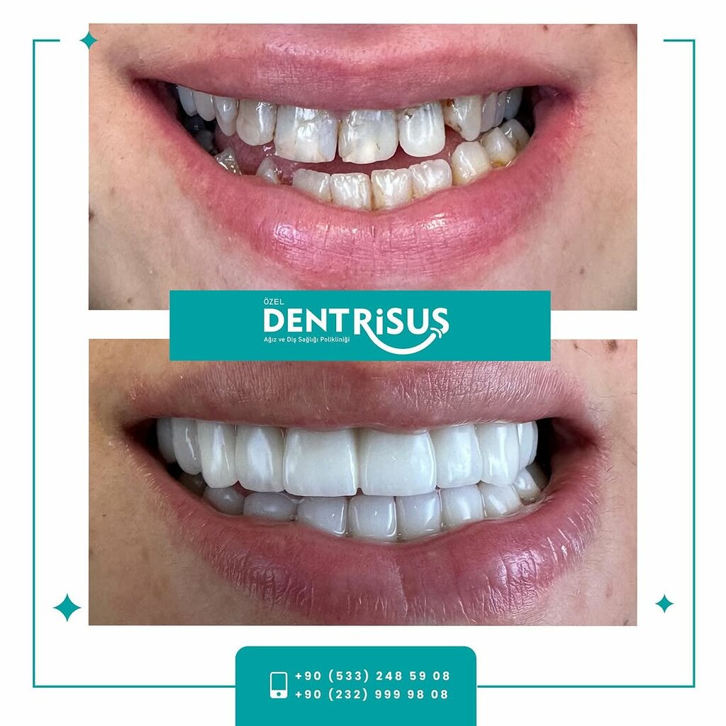 Özel ağız ve diş sağlığı klinikleri ve muayenehaneleri Dent Risus Diş Kliniği, İzmir, foto