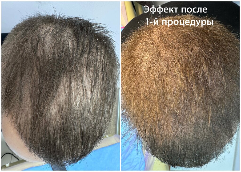 Dövmeciler Студия трихопигментации и перманентного макияжа Artscalp, İvanovo, foto