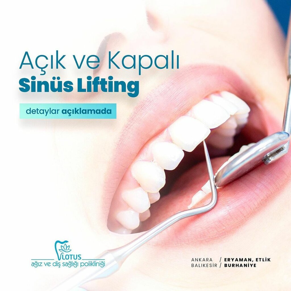 Özel ağız ve diş sağlığı klinikleri ve muayenehaneleri Lotus Ağız ve Diş Sağlığı Polikliniği, Ankara, foto