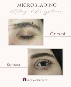 Epilasyon Gökçem Estetik & Güzellik, Araklı, foto