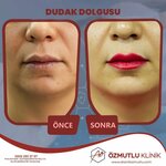 OpDr Anıl Özmutlu Genel Cerrahi Uzmanı (Gaziantep, Şehitkamil, Pancarlı Mah., Ayıntaplı Mehmet Bey Cad., 24), özel muayenehaneler  Gaziantep'ten
