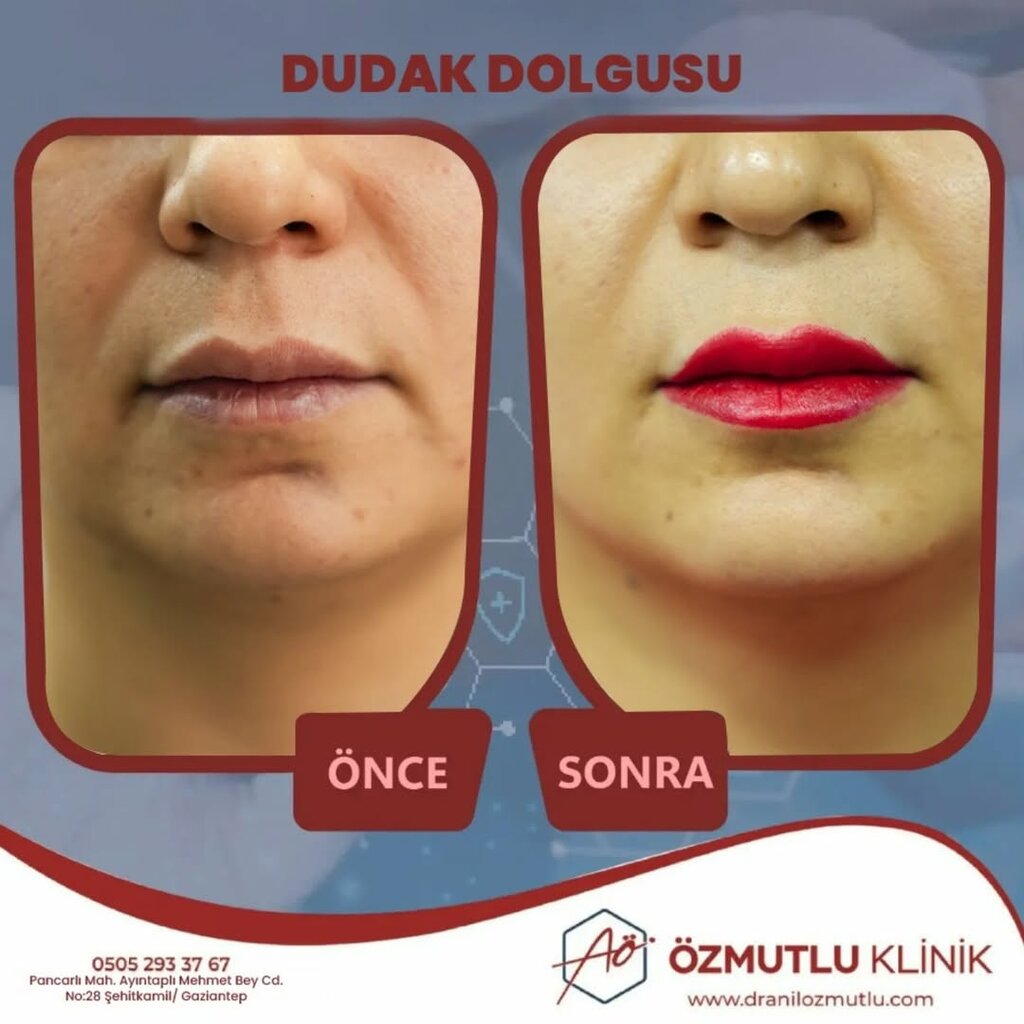 Özel muayenehaneler OpDr Anıl Özmutlu Genel Cerrahi Uzmanı, Gaziantep, foto