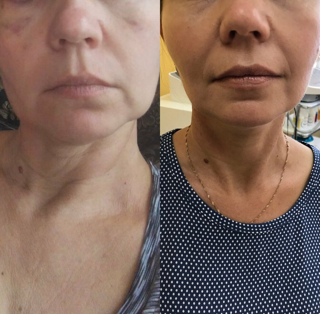 Kozmetoloji, kozmetik salonları ViShi cosmo, Moskova, foto