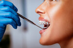 Dente Dental Studio (İzmir, İzmir Çevre Yolu Blv., 33), özel ağız ve diş sağlığı klinikleri ve muayenehaneleri  İzmir'den
