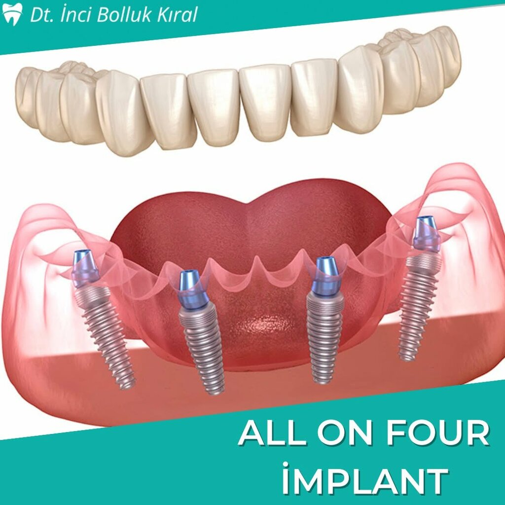 Özel ağız ve diş sağlığı klinikleri ve muayenehaneleri İnci Bolluk Kıral Diş Hekimi, İstanbul, foto