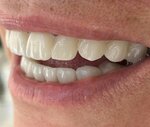 Diş Hekimi Faruk Kayadelen (Yenimahalle Mah., 3081. Sok., No:22, Atakum, Samsun), özel ağız ve diş sağlığı klinikleri ve muayenehaneleri  Atakum'dan