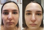 Igor Bogomolov's facial correction massage studio (Posyetskaya Street No:34), masaj salonları  Vladivostok'tan