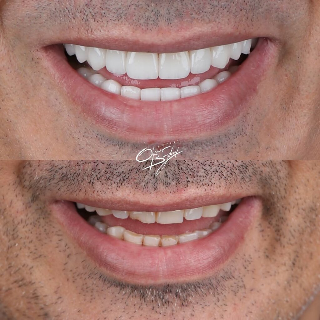 Özel ağız ve diş sağlığı klinikleri ve muayenehaneleri Diş Hekimi Onur Baykal, İstanbul, foto