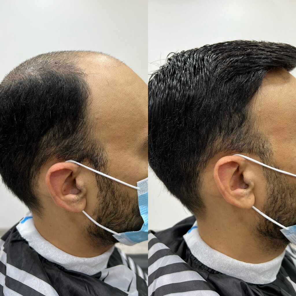 Tıp merkezleri ve klinikler Base Line Hair Fixing, Dubai, foto