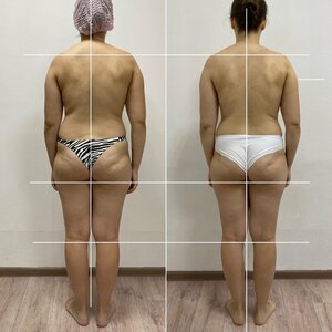 Masaj salonları Студия массажа Джамили Слепцовой, Anjero‑Sudjensk, foto