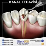 Esdental Gross Ağız ve Diş Sağlığı Polikliniği (Kırıkkale, Kırıkkale Merkez, Cengiz Topel Cad., 8), özel ağız ve diş sağlığı klinikleri ve muayenehaneleri  Kırıkkale'den