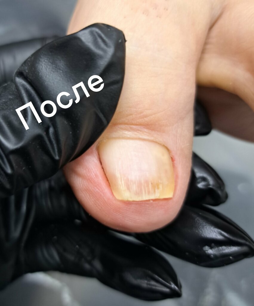 Podoloji Кабинет подолога, Aramil, foto