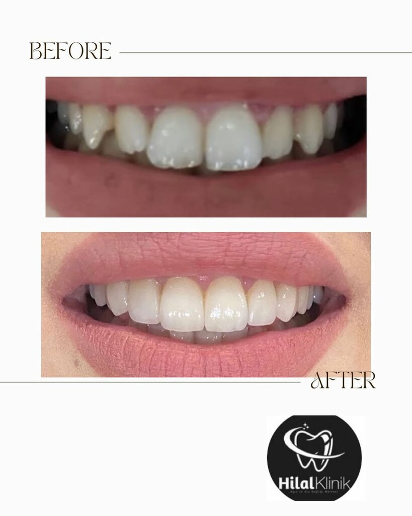 Özel ağız ve diş sağlığı klinikleri ve muayenehaneleri Diş Hekimi Fatih Gülcü, İstanbul, foto