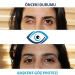 Başkent Göz Protezi Diyarbakır Şubesi (Diyarbakır, Yenişehir, Elazığ Bul., 13B), aile sağlığı merkezi  Diyarbakır'dan