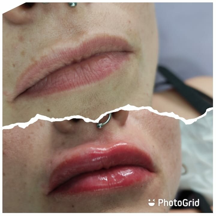 Plastik cerrahi klinikleri Capri - Med Clinic, Bilbao, foto