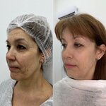 LuA. Clinic (Kolomyazhskiy Avenue No:5к3), kozmetoloji, kozmetik salonları  Saint‑Petersburg'dan