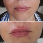 Op. Dr. Dicle Sevük Estetik Cerrahi Muayenehanesi (İstanbul, Ataşehir, Barbaros Mah., Ak Zambak Sok., 3B), özel muayenehaneler  İstanbul'dan