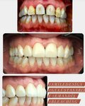 Alp Dental Ağız ve Diş Polikliniği (Nevşehir, Nevşehir Merkez, Güzelyurt Mah., 80. Yıl Blv., 4), özel ağız ve diş sağlığı klinikleri ve muayenehaneleri  Nevşehir'den