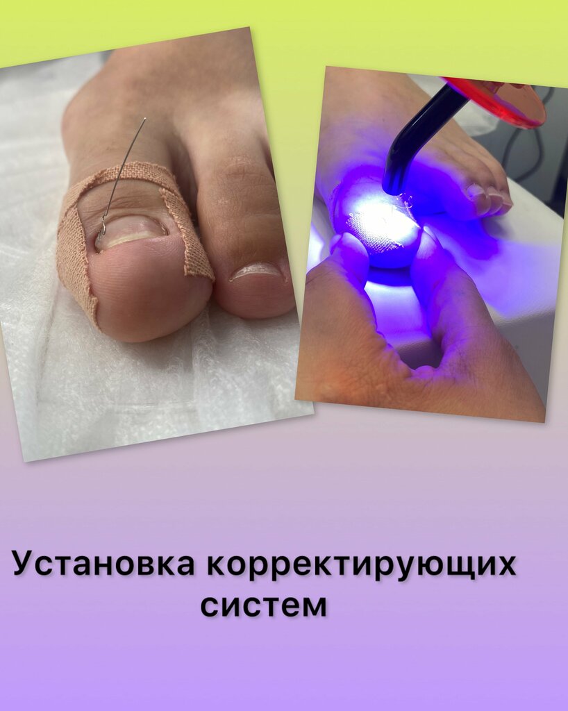 Podoloji Центр педикюра и подологии Ирины Фроленко, Krasnodar, foto