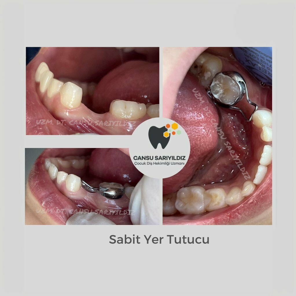 Özel muayenehaneler Uzman Diş Hekimi Cansu Sarıyıldız - Pedodontist Çocuk diş hekimliği uzmanı, Diyarbakır, foto