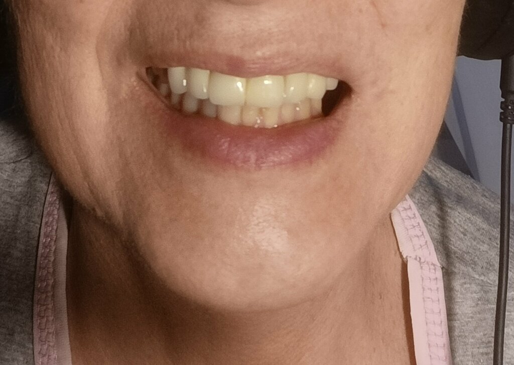 Özel ağız ve diş sağlığı klinikleri ve muayenehaneleri Лидер-дент, Yaroslavl, foto