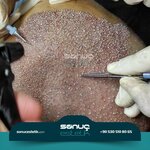 Sonuç Estetik Saç Ekimi (Hatay, Antakya, Odabaşı Mah., Uğur Mumcu Blv., 103), tıp merkezleri ve klinikler  Antakya'dan
