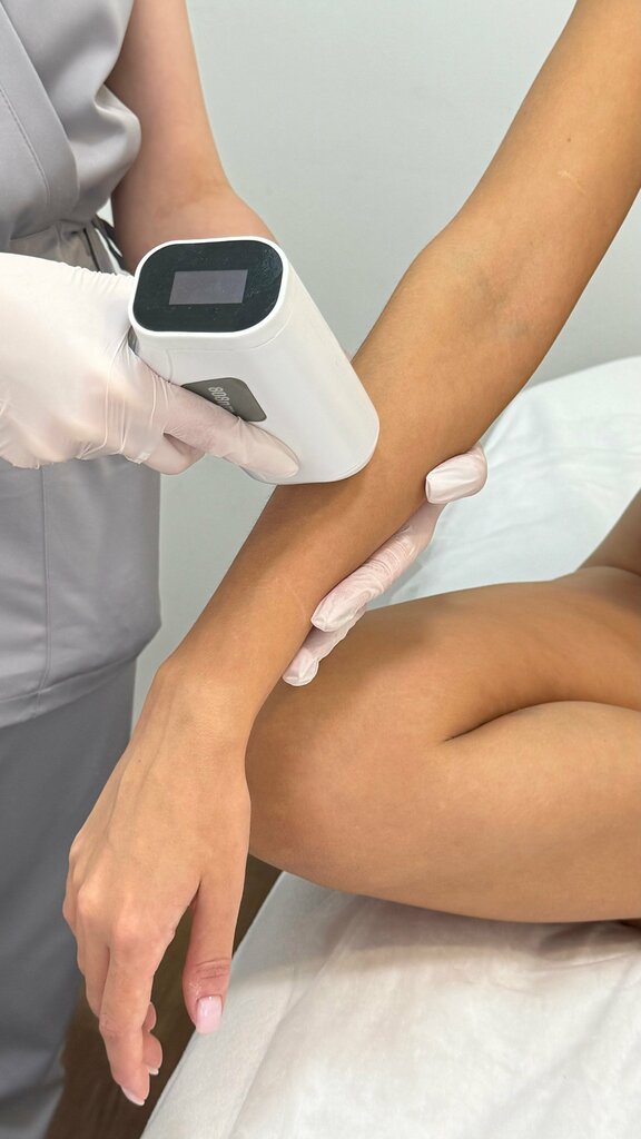 Epilasyon Eko laser, Krasnoyarsk, foto